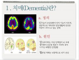 [학술제] 치매(Dementia).ppt-1페이지