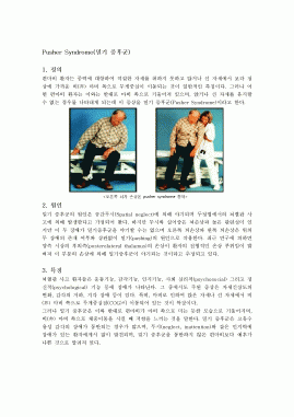 [뇌손상] Pusher Syndrome[밀기 증후군]에 대해-1페이지