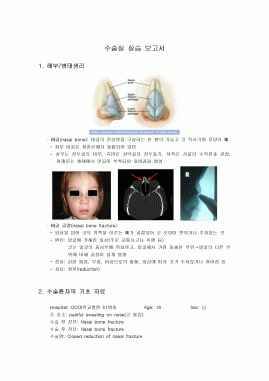 수술실(OR) 실습보고서 - 비골 골절(nasal bone fracture)-1페이지