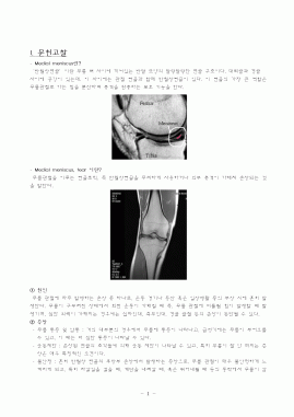 Meniscus 반월상연골 케이스-1페이지