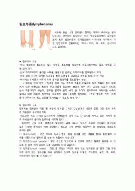 [병리학] 림프부종[lymphedema]에 관해-1페이지