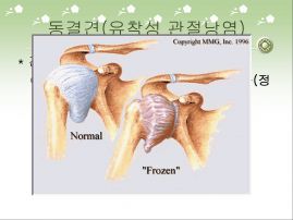 [물리치료] 동결견 및 slap 병변-1페이지