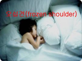 [의학] 오십견[frozen shoulder]에 관해-1페이지