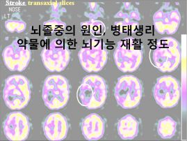 뇌졸중 전반조사 (해부/병태생리/약물/치료개발동향).ppt-1페이지