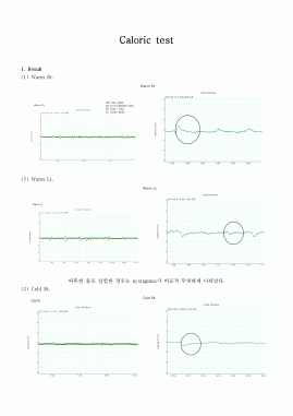 Caloric test 실습보고서 by-1페이지