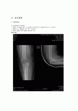 상지골절 (윤보나)-1페이지