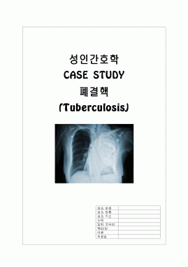 폐결핵케이스스터디 폐결핵약물종류 폐결핵진단검사 폐결핵병태생리 폐결핵문헌고찰 폐결핵간호과정 폐결핵간호진단 tuberculosis case study 결핵케이스-1페이지