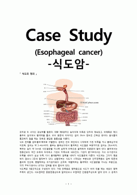 [성인간호학][Esophageal cancer][식도암] 케이스 스터디(Case Study), 문헌고찰-1페이지