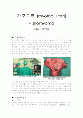 [모성학] 자궁근종 (myoma uteri=leiomyoma) -1페이지