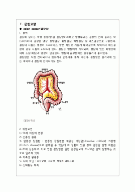 [성인간호학] 결장암 케이스 스터디 (colon cancer case study) 간호과정-1페이지