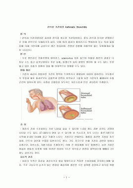 천식 케이스 스터디 (문헌고찰 : 천식성 기관지염 Asthmatic Bronchitis & 소아 천식 Pediatric asthma)-1페이지