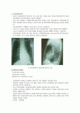 인공심박조율기 (pacemaker)-1페이지