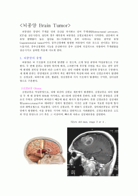 Brain _ tumor-1페이지