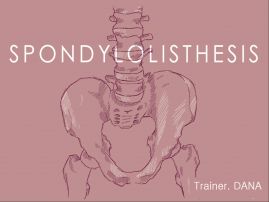 (스포츠의학, 운동처방관련학과) Spondylolisthesis 척추전방전위증 -정의 원인 증상 및 운동방법-1페이지