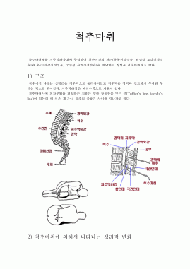 척추마취의 특성과 합병증-1페이지