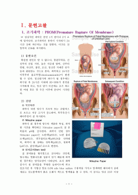  여성간호학실습 조기양막파수(조기파막) PROM 케이스스터디-1페이지