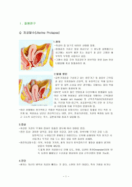  여성간호학실습 자궁탈수 Uterine Prolapse 케이스-1페이지