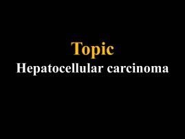 Hepatocellular carcinoma 간세포 암종.pptx-1페이지