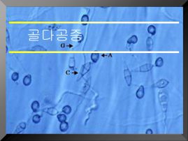 골다공증.ppt-1페이지