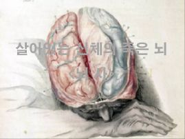 평가우수자료뇌사(腦死)-살아있는 신체의 죽은 뇌 뇌사의 정의, 뇌사의 개념, 죽음의 판단, 뇌사 찬성, 뇌사 반대, 뇌사 해결방안.pptx-1페이지