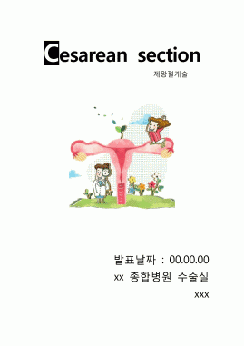 cesarean section 제왕절개술 - 정리, 정의, 구조, 기능, 종류, 수술-1페이지