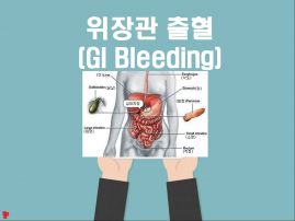 위장관 출혈 GI Bleeding 문헌고찰 정의 병태생리 증상 치료 간호과정 3개-1페이지