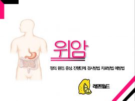  위암 - 정의, 원인, 증상, 진행단계, 검사방법, 치료방법, 예방법-1페이지