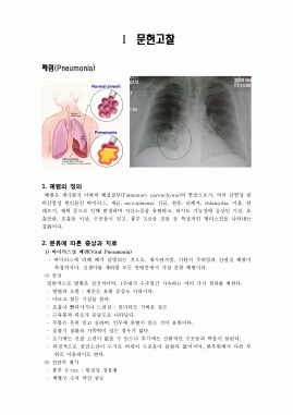 폐렴(Pneumonia) CASE STUDY!-1페이지
