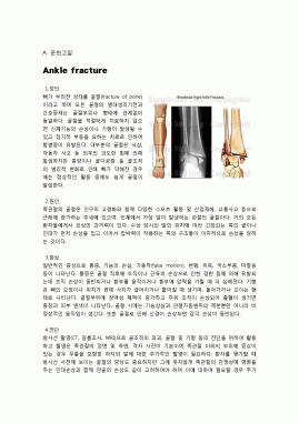 ankle fracture 간호진단-1페이지