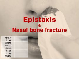 응급간호학 코피 epistaxis 비골 골절 nasal bone fracture 발표 자료-1페이지