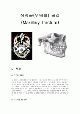 A+++상악골 골절(위턱뼈 골절) 케이스(연구의 필요성부터 ~ 문헌고찰,간호과정, 간호사정, 간호진단, 느낀점)-1페이지