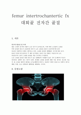 A++++대퇴골 전자간 골절(femur intertrochantertic fx) 케이스: 연구의 필요성부터 ~ 문헌고찰,간호과정, 간호사정, 간호진단-1페이지