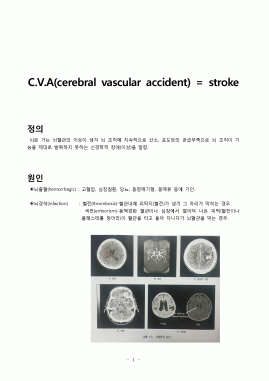 CVA(cerebral vascular accident) = stroke-1페이지