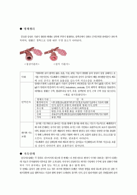 천식 병태생리, 간호, 간호진단 3개-1페이지