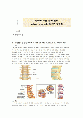 spine 수술 환자 간호 (척추관 협착증 케이스,spine케이스, spinal stenosis 간호과정, spinal stenosis 케이스, 척추관 협착증 간호과정, 척추관 협착증 CASE )-1페이지