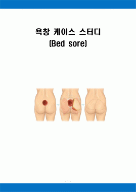 욕창 케이스 스터디 A+ ( 욕창 케이스 스터디, 욕창 간호과정, BED SORE CASE STUDY, 욕창 간호진단, 욕창 실습, 욕창간호, 욕창 사례연구)-1페이지