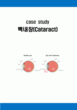 백내장(Cataract) 케이스 스터디 A+ - (백내장 케이스 스터디, 백내장 간호과정, 백내장 간호진단, 안과 실습, CATARACT CASE STUDY, 백내장 CASE STUDY, 백내장 사례연구)-1페이지