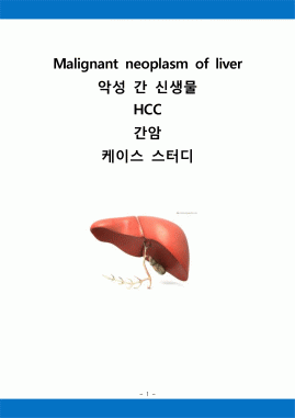 Malignant neoplasm of liver 악성 간 신생물 케이스 ,HCC 간암 케이스 스터디 ( 간 신생물 케이스, 간암 케이스, HCC CASE, 간 신생물 간호과정, 간암 문헌고찰)-1페이지