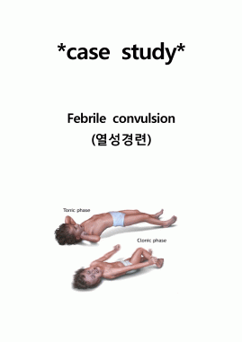 열성경련-아동간호 케이스 스터디-1페이지