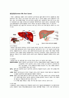 총담관암 질환보고서-1페이지