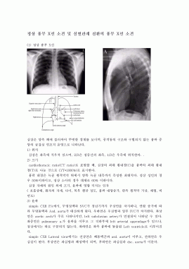 [의대 본과 pk 실습] 정상 흉부 X선 소견 및 심혈관계 질환의 흉부-1페이지