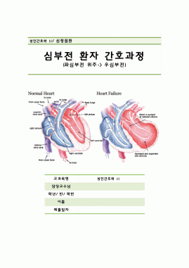 심부전 간호과정-1페이지