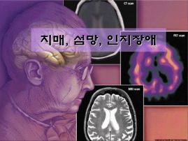 치매,섬망,기억인지장애,기질성 정신장애란,감염물질설,유전적 요인,대사장애,알츠하이머형 치매,혈관성 치매,파킨슨 치매-1페이지