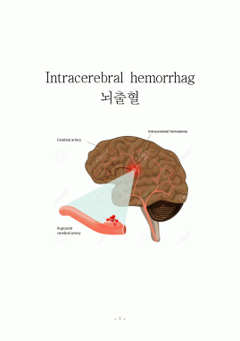 뇌출혈 cerebral hemorrhage-1페이지