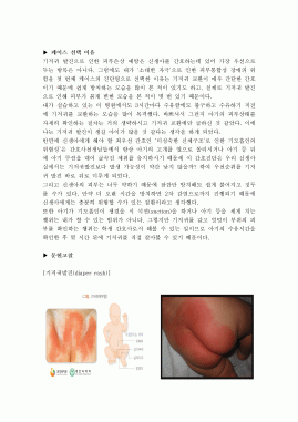 기저귀발진에 대한 문헌고찰 및 간호과정-1페이지