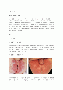 아동간호학  기저귀발진 케이스-1페이지