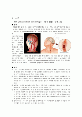 뇌내출혈 , ICH 케이스, NSICU, 뇌내출혈case,ICH case-1페이지