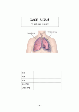 성인간호학실습 기흉 케이스보고서-1페이지