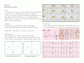 성인간호학 - 과제 심근경색(myocardiac infarction)-1페이지