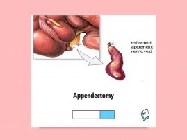 [성인간호학실습]appendectomy충수절제술 수술과정ppt발표 충수염부터 수술기구.과정.후간호까지 사진 많고 꼼꼼함-1페이지